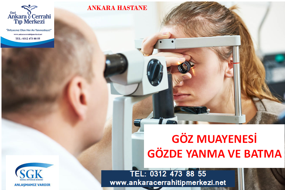 Göz Sağlığı Gözde Yanma Batma - Özel Ankara Cerrahi Tıp Merkezi