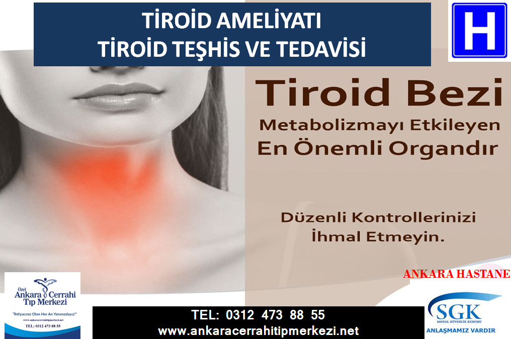 Tiroid Hastalığı Nasıl Anlaşılır, Tedavisi Nedir? - Özel Ankara Cerrahi ...