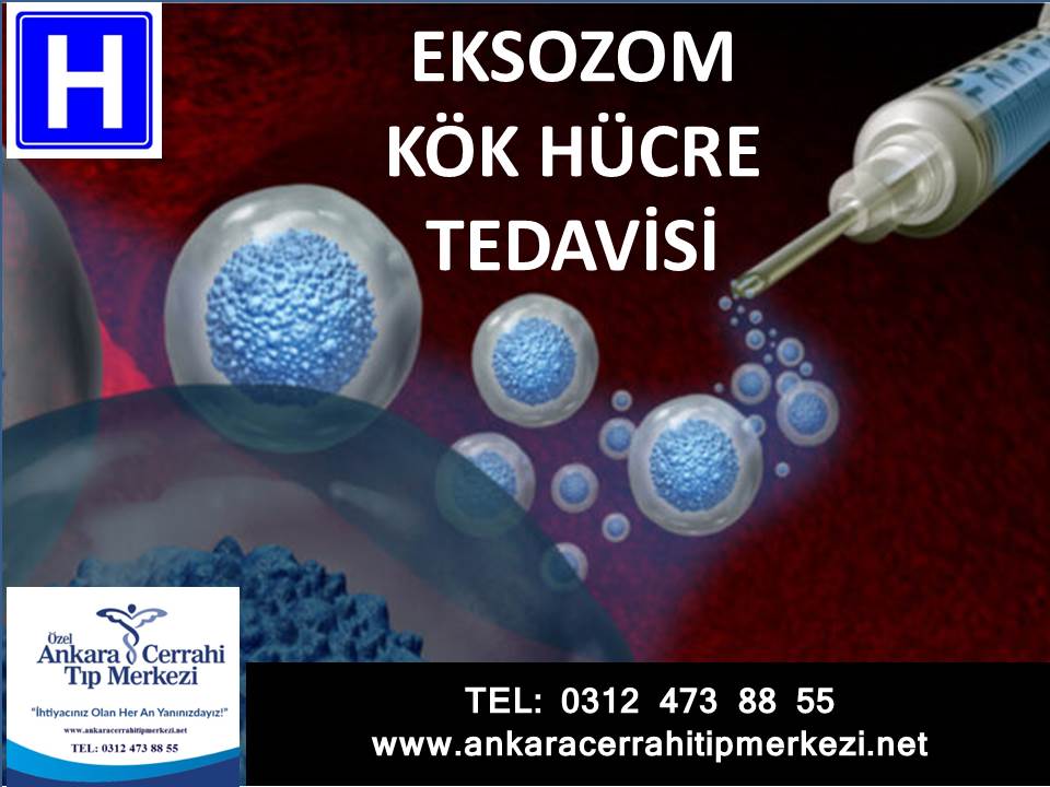 Varikosel Nedir ? Varikosel Tedavisi - Özel Ankara Cerrahi Tıp Merkezi ...